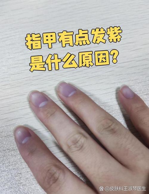 女性手指甲发紫要警惕图标