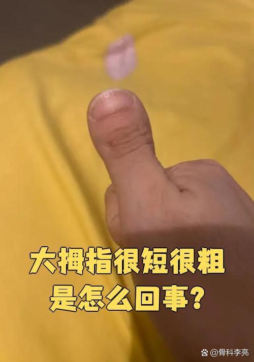 大拇指短图标