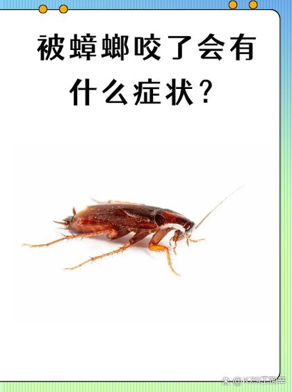 被蟑螂咬了怎么办?图标
