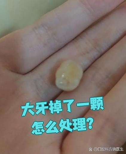 大牙会掉吗截图