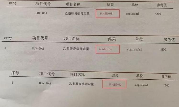 乙肝dna病毒定量正常范围多少啊图标