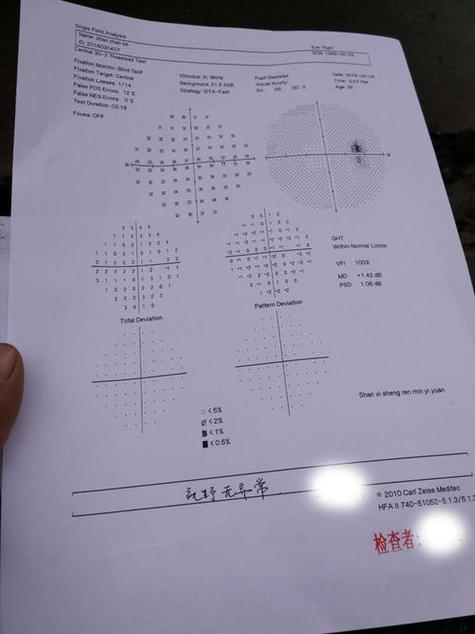 视野检查结果图怎么看图标