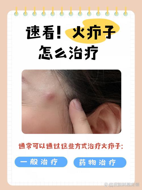 疮疖是什么样子图片图标