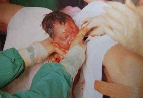 孕妇生孩子生不出来图标