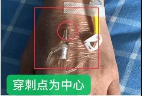 针不在中间最简单三个步骤截图
