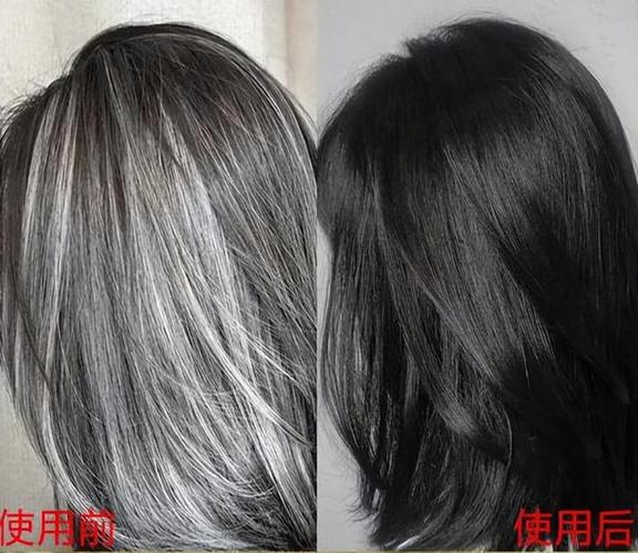 白发真能变黑吗图标