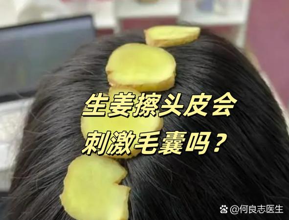 用生姜片擦头皮可以生发吗截图