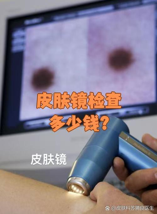 皮肤镜检查大概多少钱图标