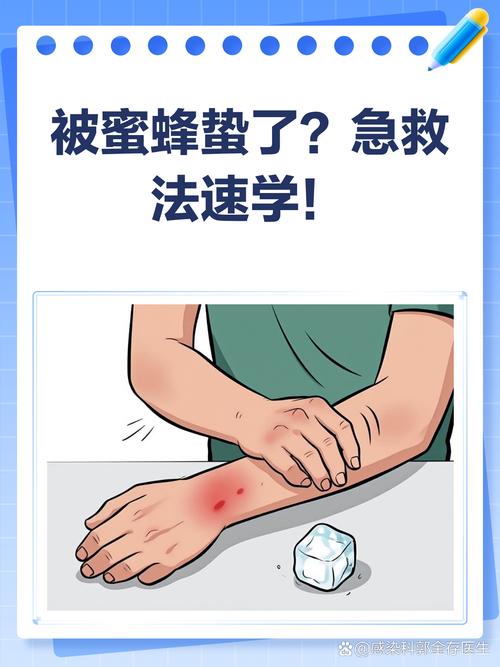 遭蜜蜂蛰了最好的处理办法图标
