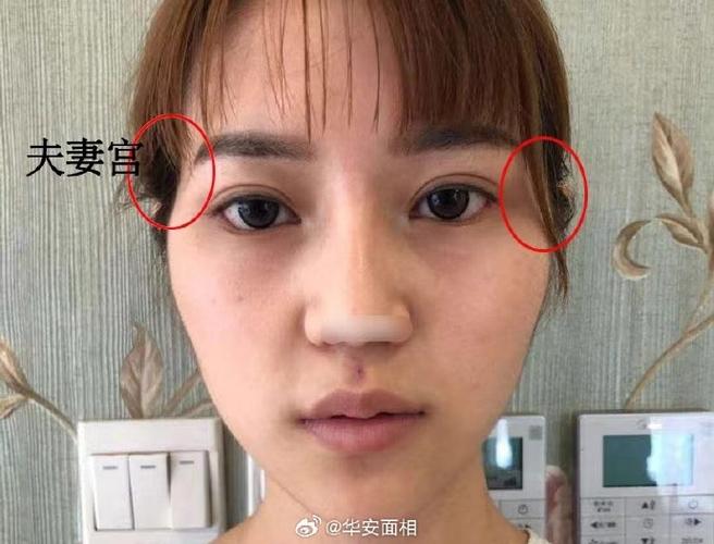 两鬓凹陷女人面相截图