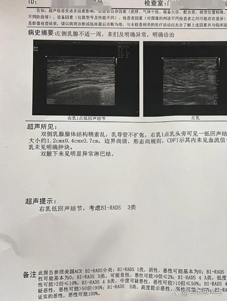 什么叫低回声区图标