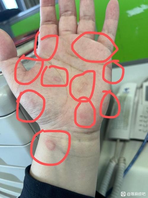 手上有圆圈代表什么意思?图标