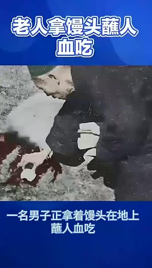 课文人血馒头图标