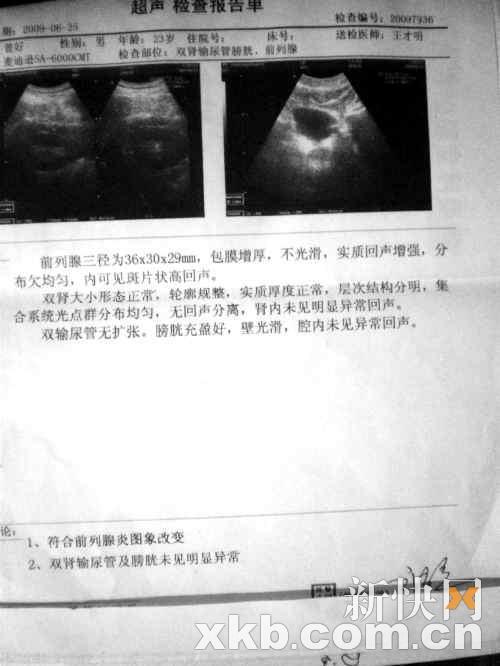 男性b超检查什么项目图标