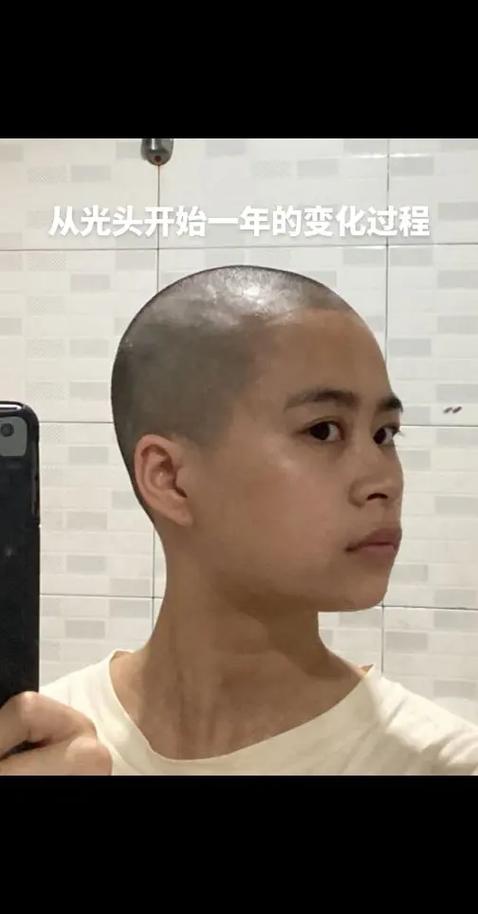 头秃图标