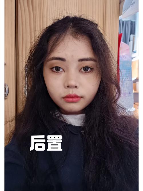 前置好看后置丑为啥截图