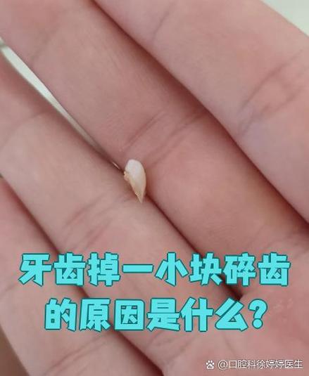牙齿磕掉一小块会长吗图标