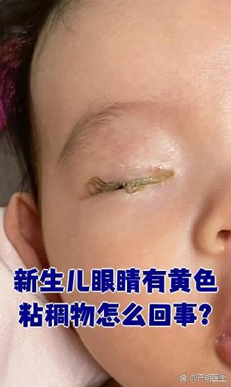 小孩眼睛流眼水图标