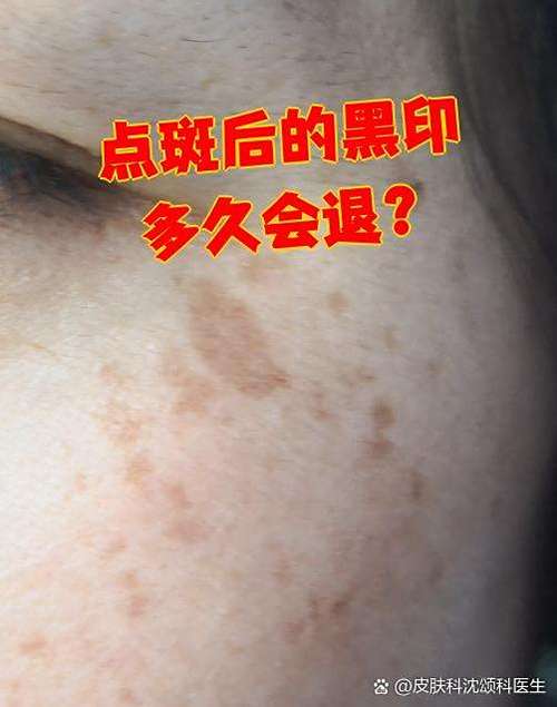 复印机打印第一张纸有黑印图标