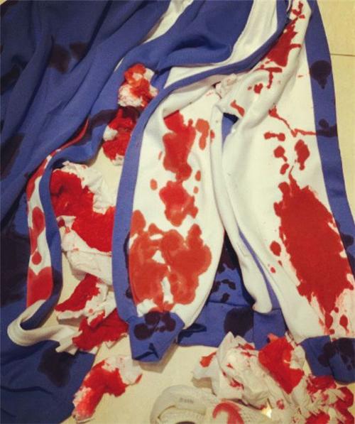 黑衣服沾上84变红了怎么补救图标