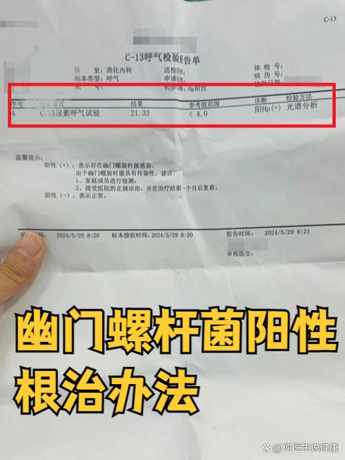 幽门螺杆菌阳性怎么治图标