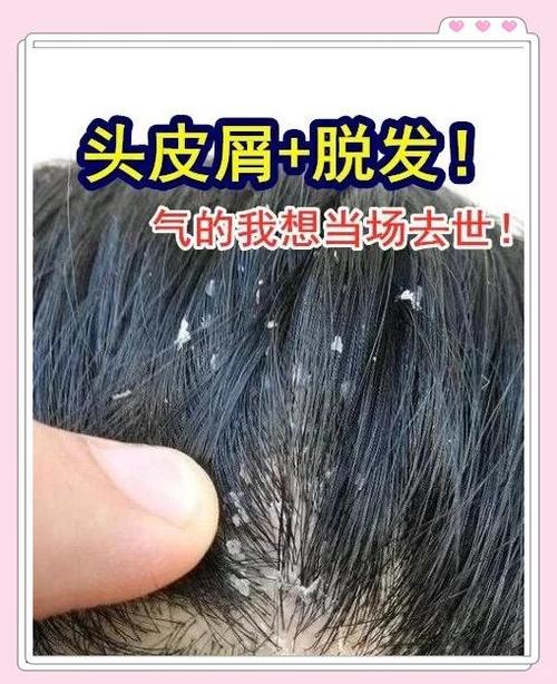 理发店做毁了我的头发图标