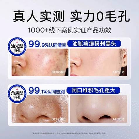 毛孔粗大做什么医美项目比较好