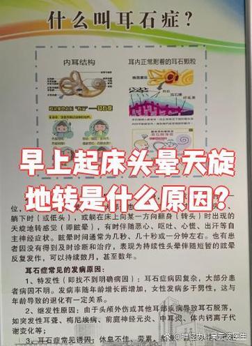 急性头晕天旋地转怎么回事图标