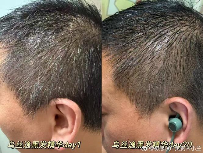 渊也白转黑效果怎么样