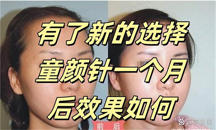 怎样从脸部看出一个人的体质截图