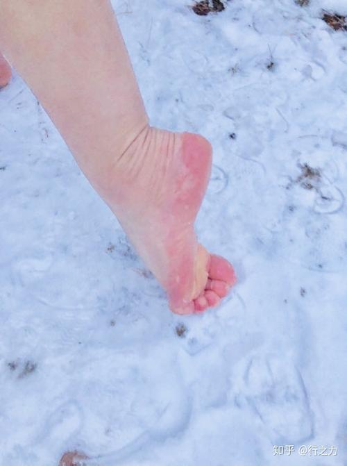雪地光脚丫图标