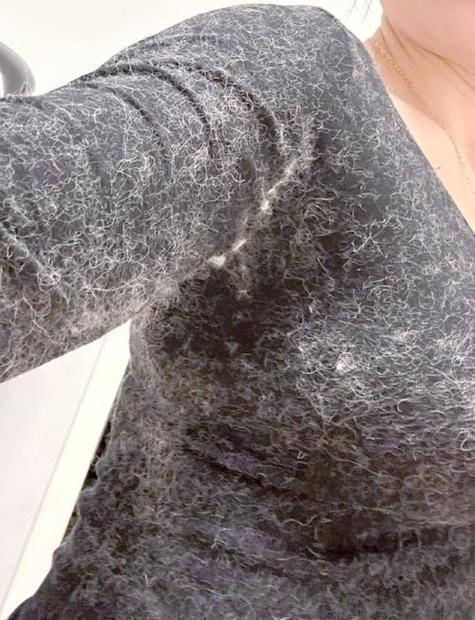 毛衣掉毛严重小妙招截图