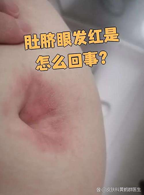 肚脐里痒痒怎么回事图标