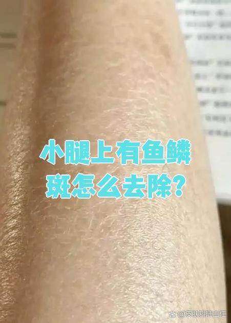 小腿上有鱼纹代表什么图标
