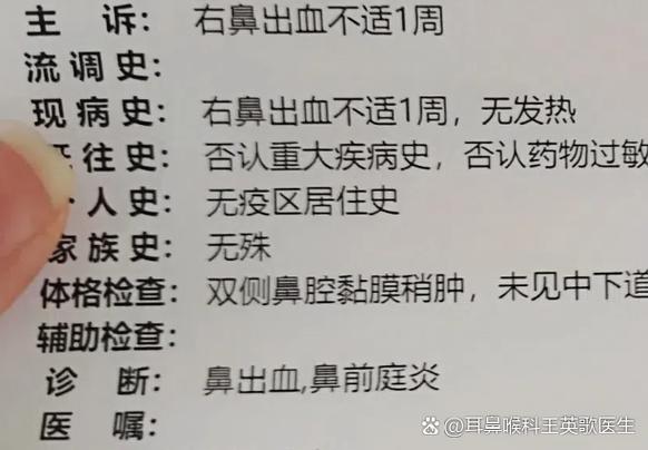 成天流鼻血是怎么回事图标