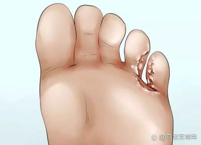 脚发痒挠了起疙瘩图标