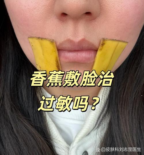 脸过敏了敷香蕉能好吗图标