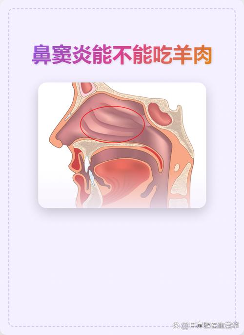 吃羊肉燥热了怎么处理截图