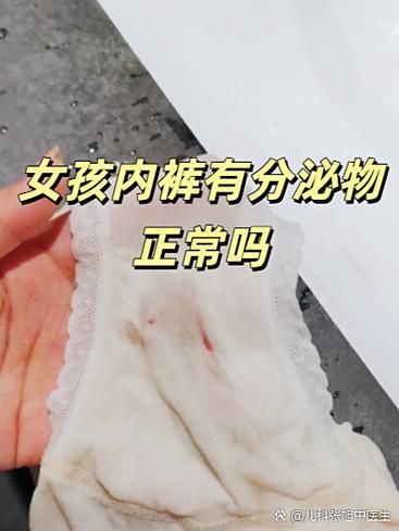 私密出现白色粘东西图标