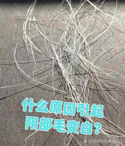 图片变白