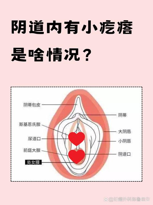 阴埠突出饱满什么原因