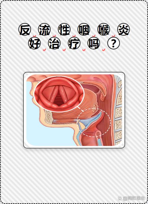 声音嘶哑怎么办图标
