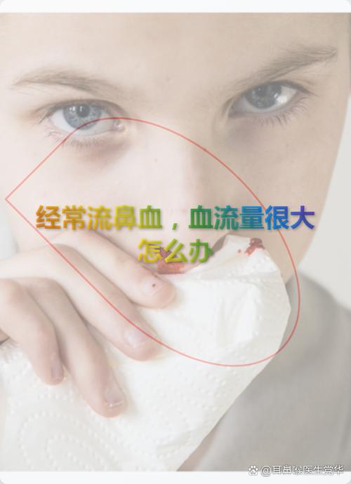 流鼻血严重怎么办图标
