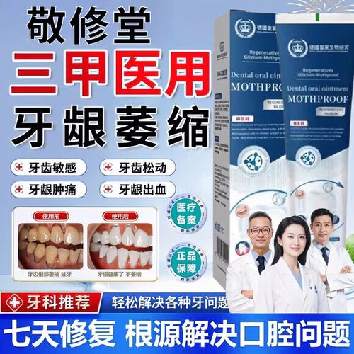 牙周炎牙膏排名第一名图标
