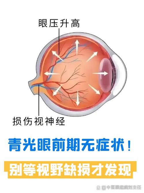 视野缺损自己能感觉吗图标
