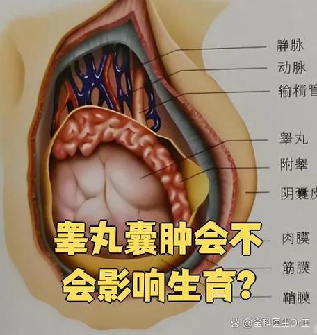 睾丸囊肿图标