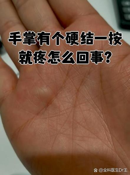 手部不固定位置的疼截图