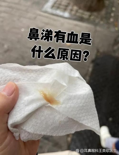 鼻涕有血但不流鼻血图标