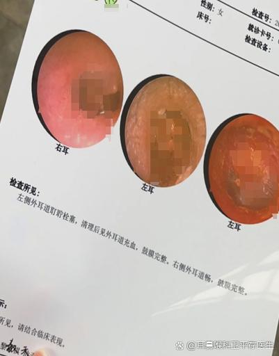耳朵有咚咚咚的声音图标