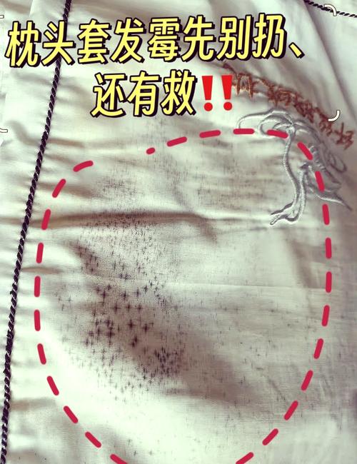 衣服上的黑印子怎么去除小窍门图标